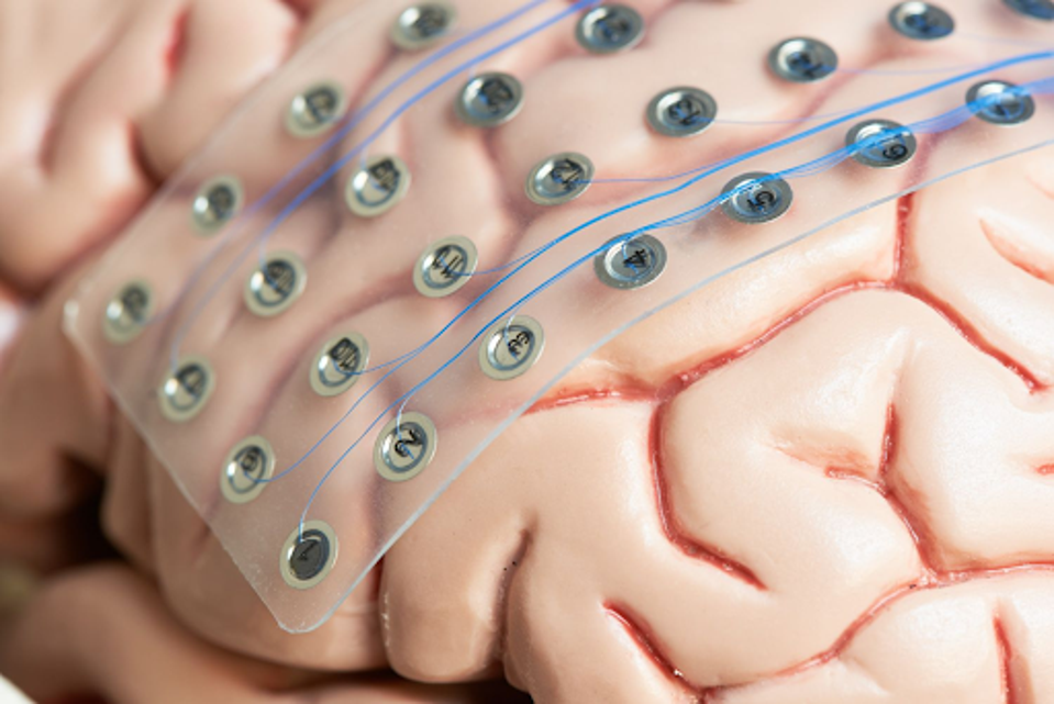 Electrical Signals Of The Brain To Control Movement – ACCESS Health ...