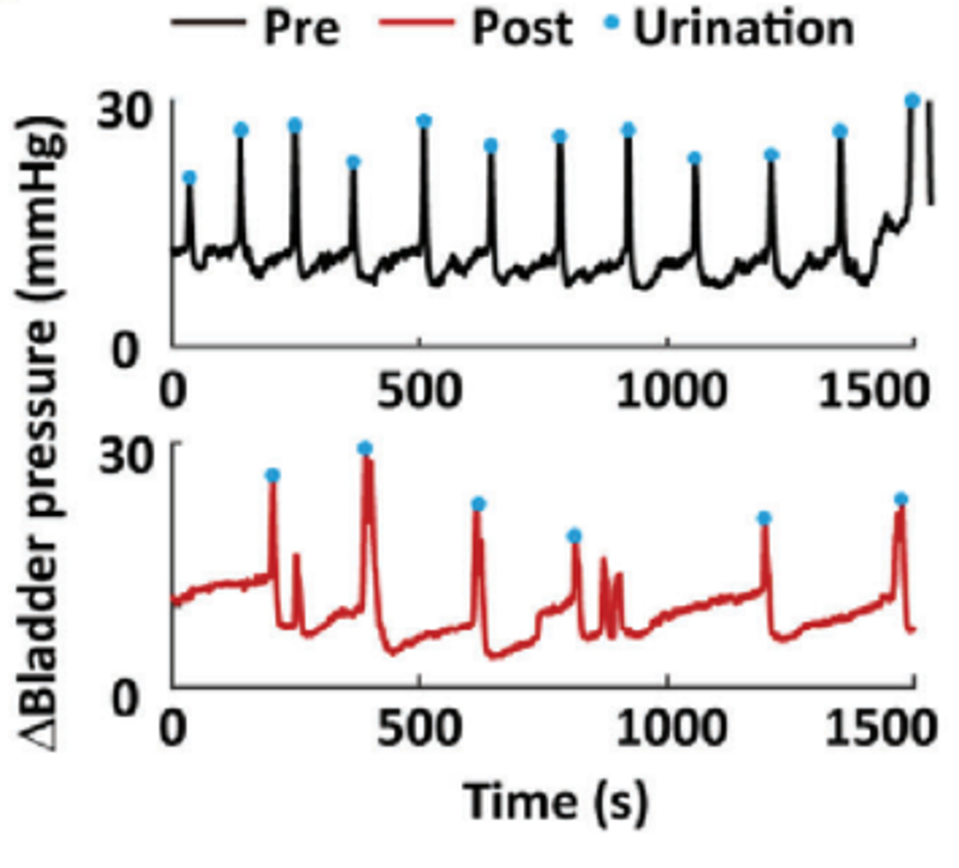 Battery-Free Implants: Powering Bioelectronics By Ultrasound – ACCESS ...
